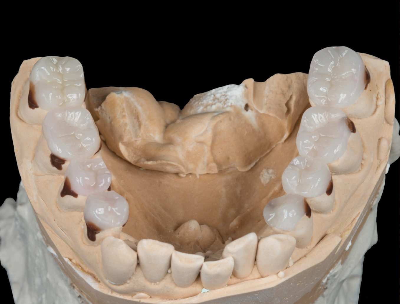 OCCLUSIONVD – edelweiss dentistry products GmbH