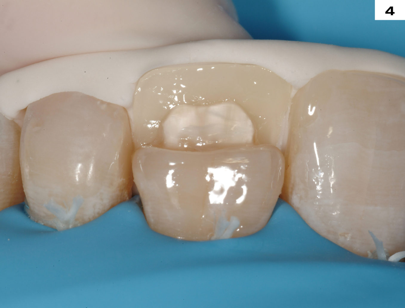 COMPOSITE – edelweiss dentistry products GmbH