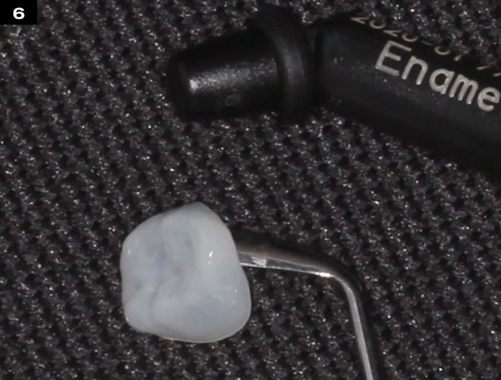 PEDIATRIC CROWN – edelweiss dentistry products GmbH