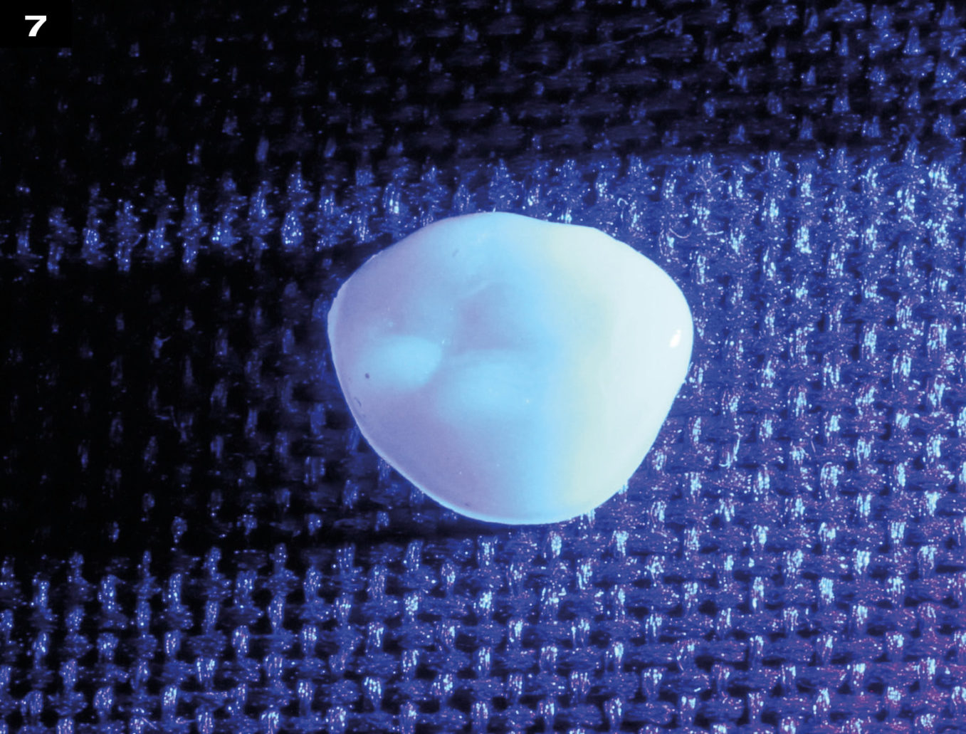 PEDIATRIC CROWN – edelweiss dentistry products GmbH